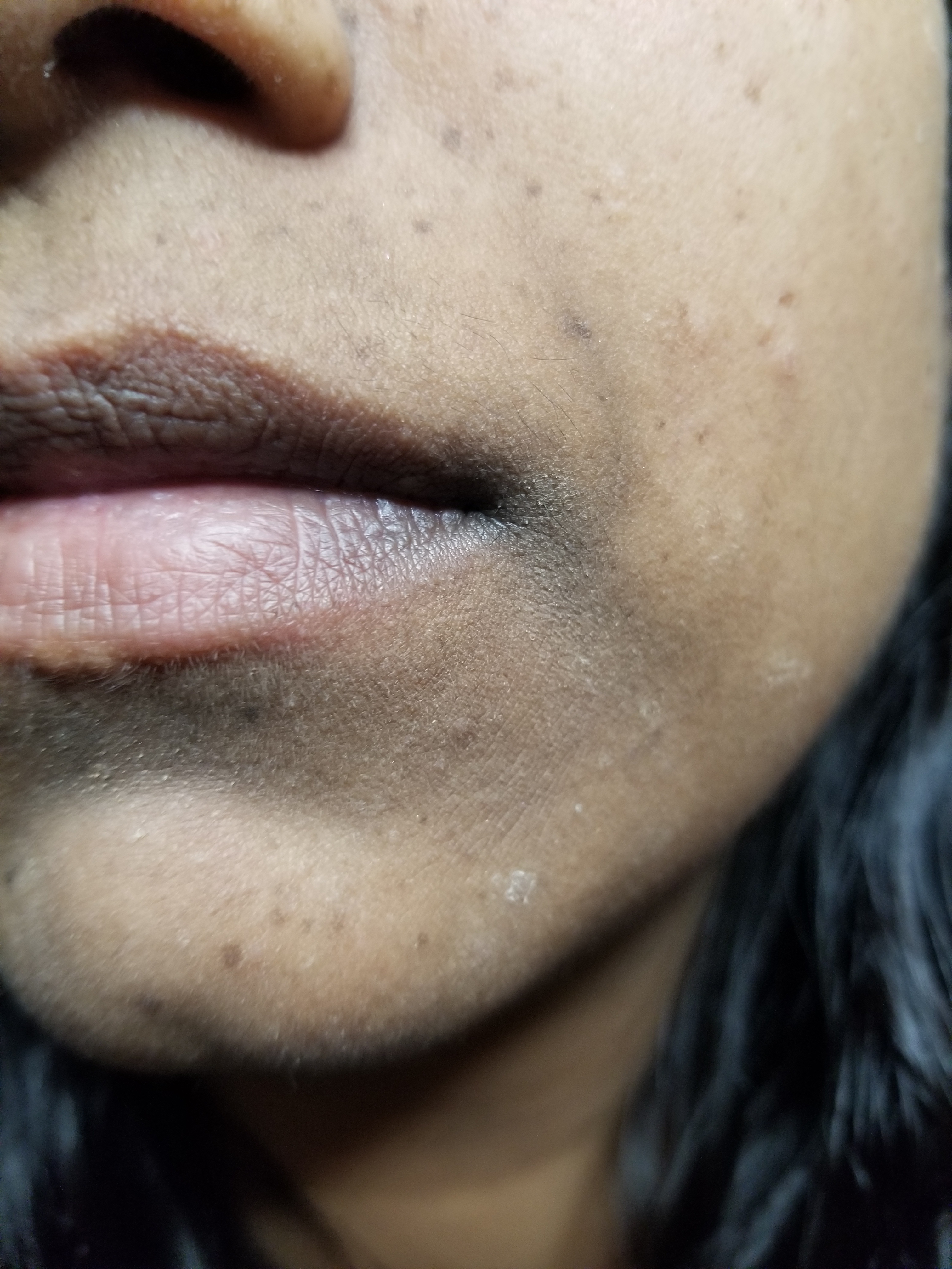 Identifying Your Skin Type: A Quick Guide for Better Skincare ...